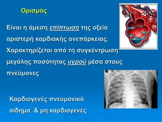 Οξύ Πνευμονικό Οίδημα | PPT