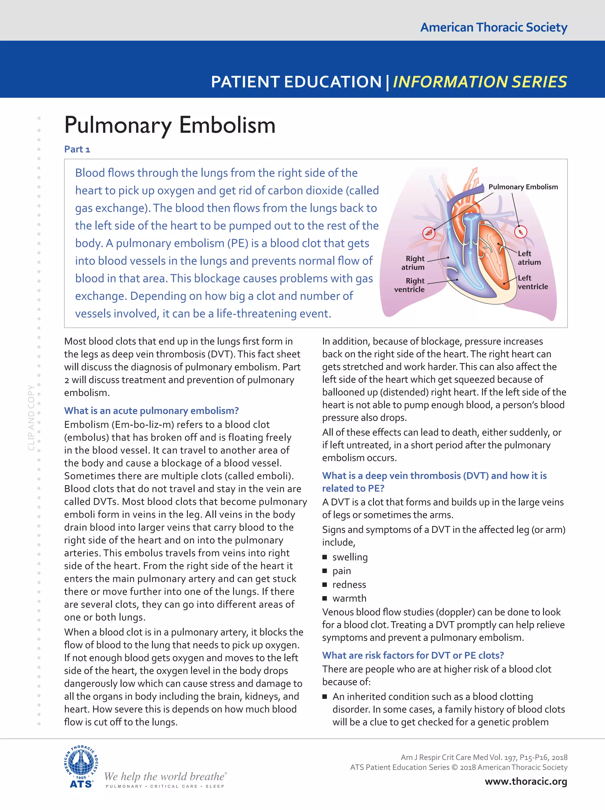 pulmonary-embolism.pdf