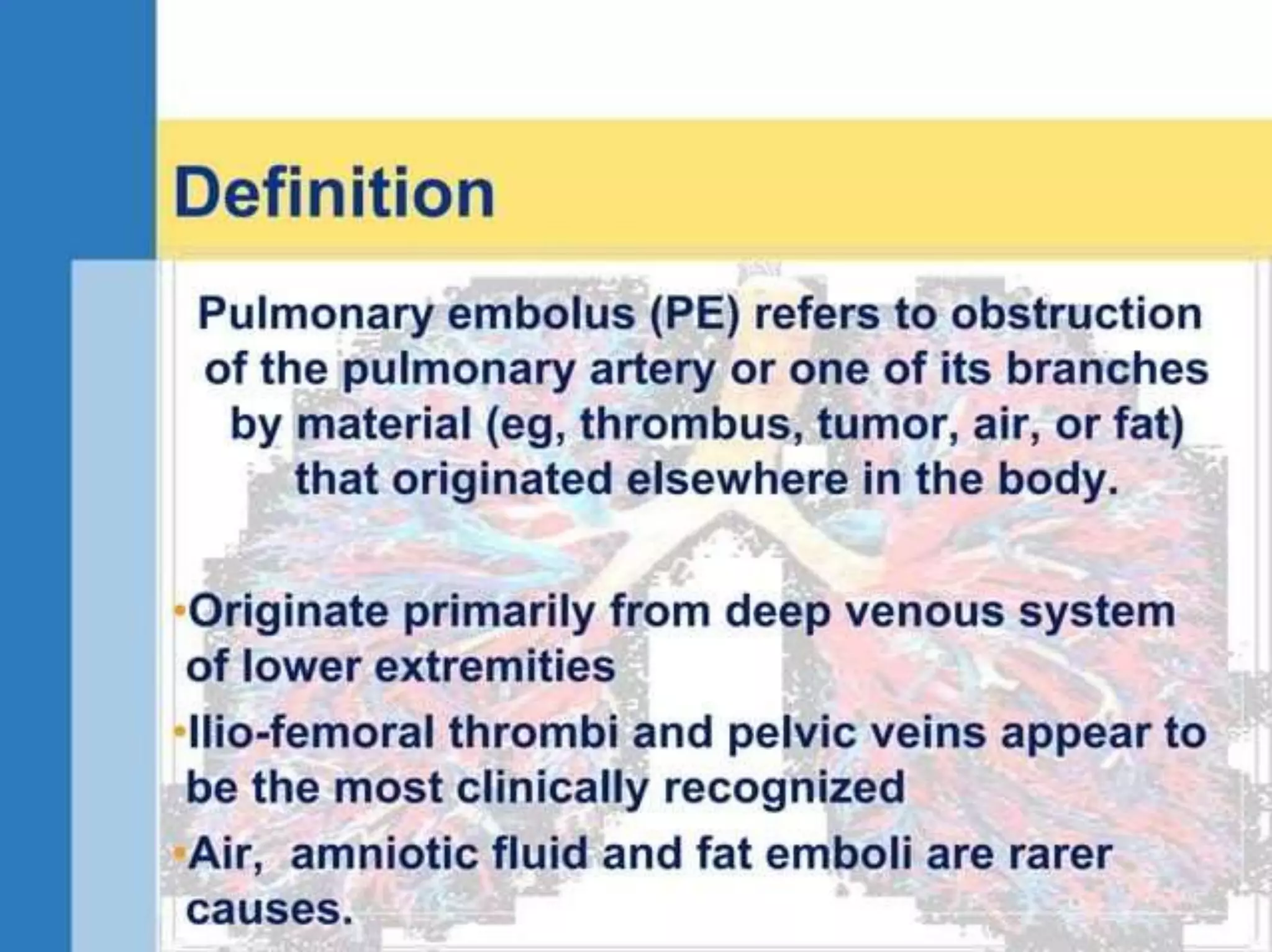 pulmonary-embolism | PPT