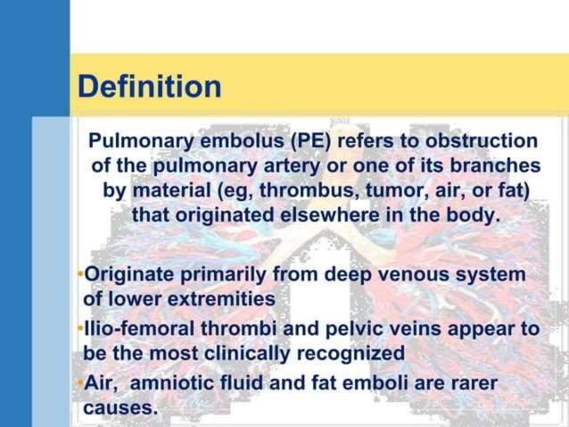 pulmonary-embolism | PPT