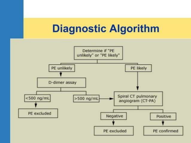 pulmonary-embolism | PPT