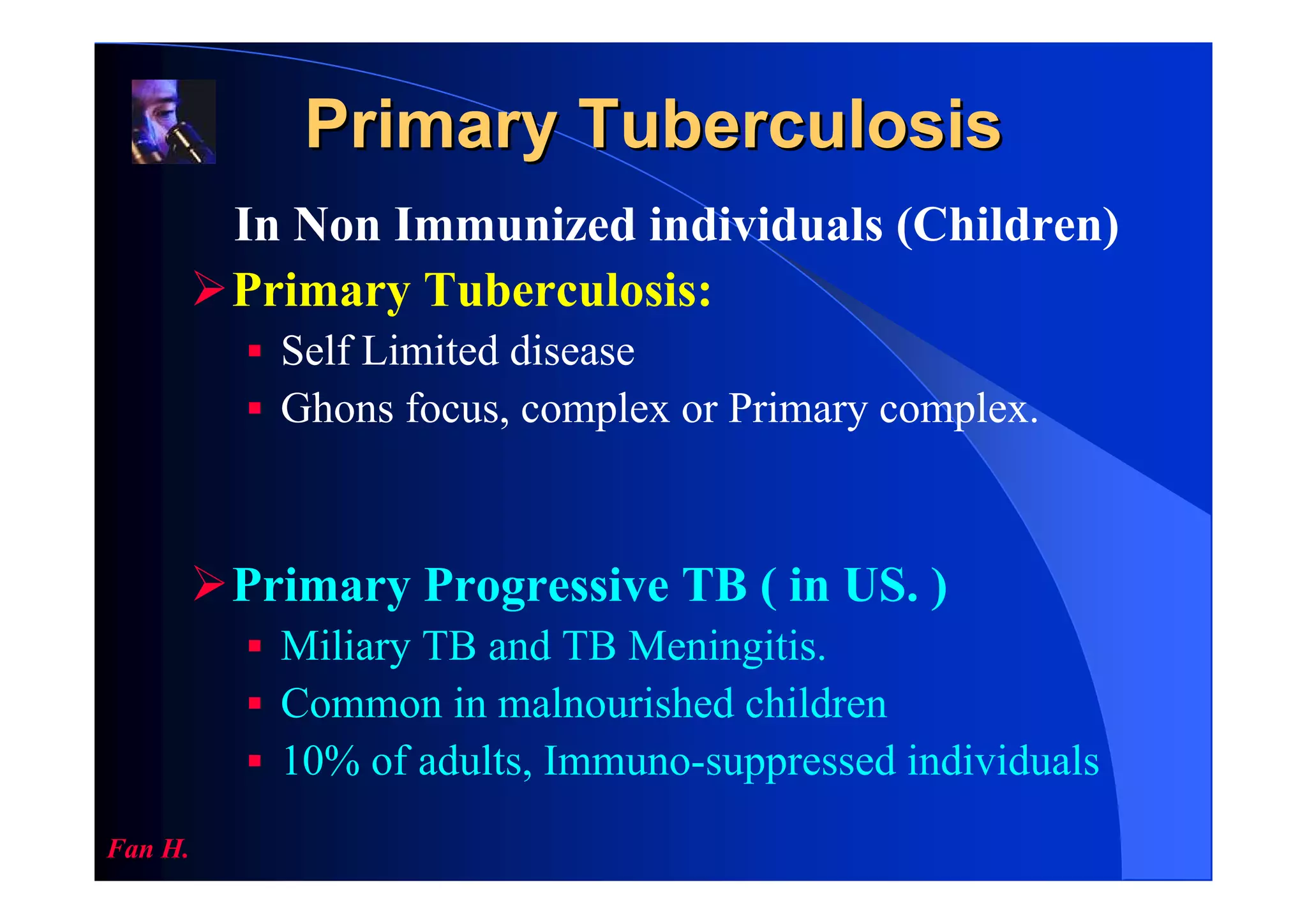 Pulmonary Tuberculosis | PDF