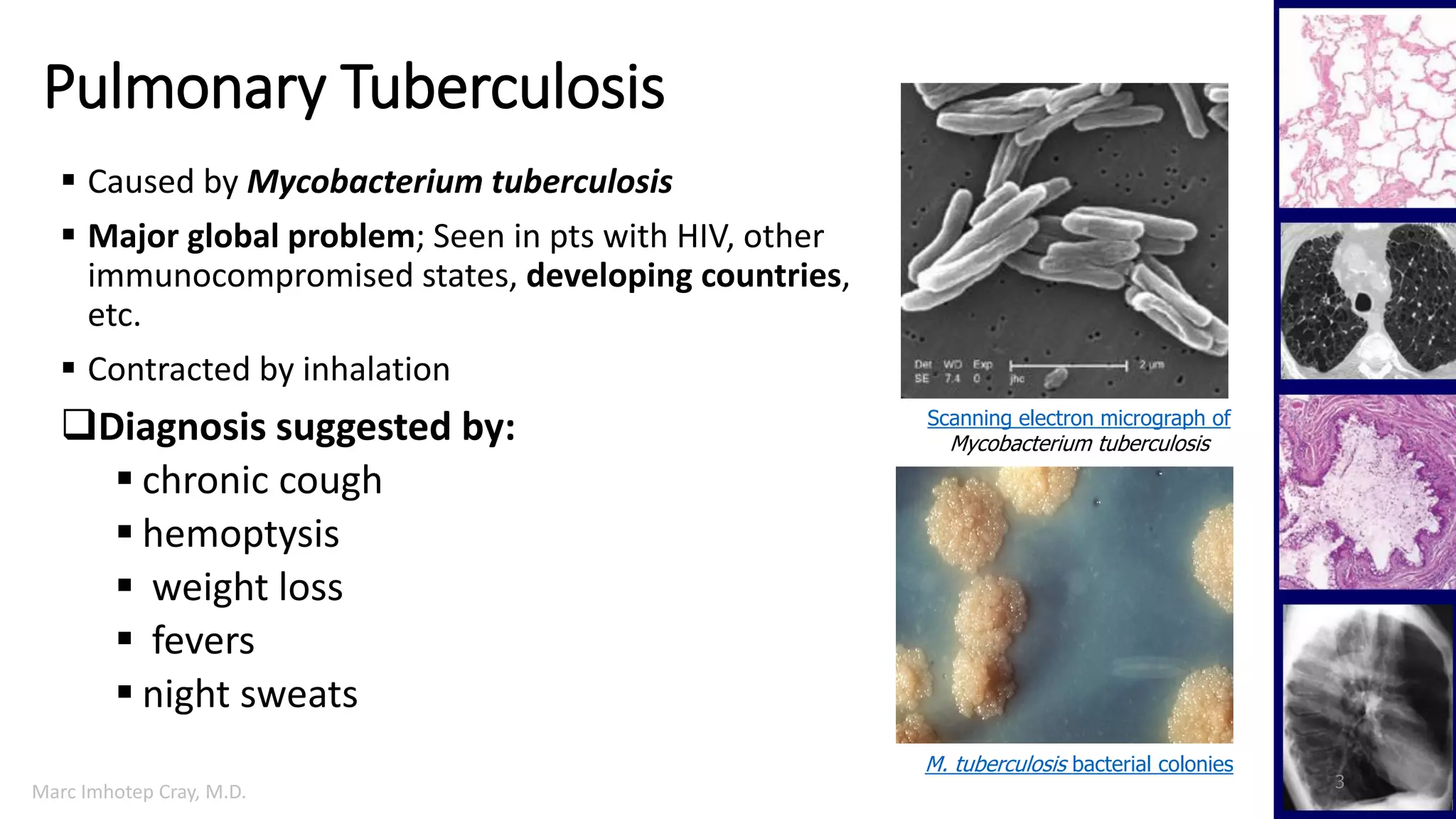 Pulmonary tuberculosis pharmacology | PDF