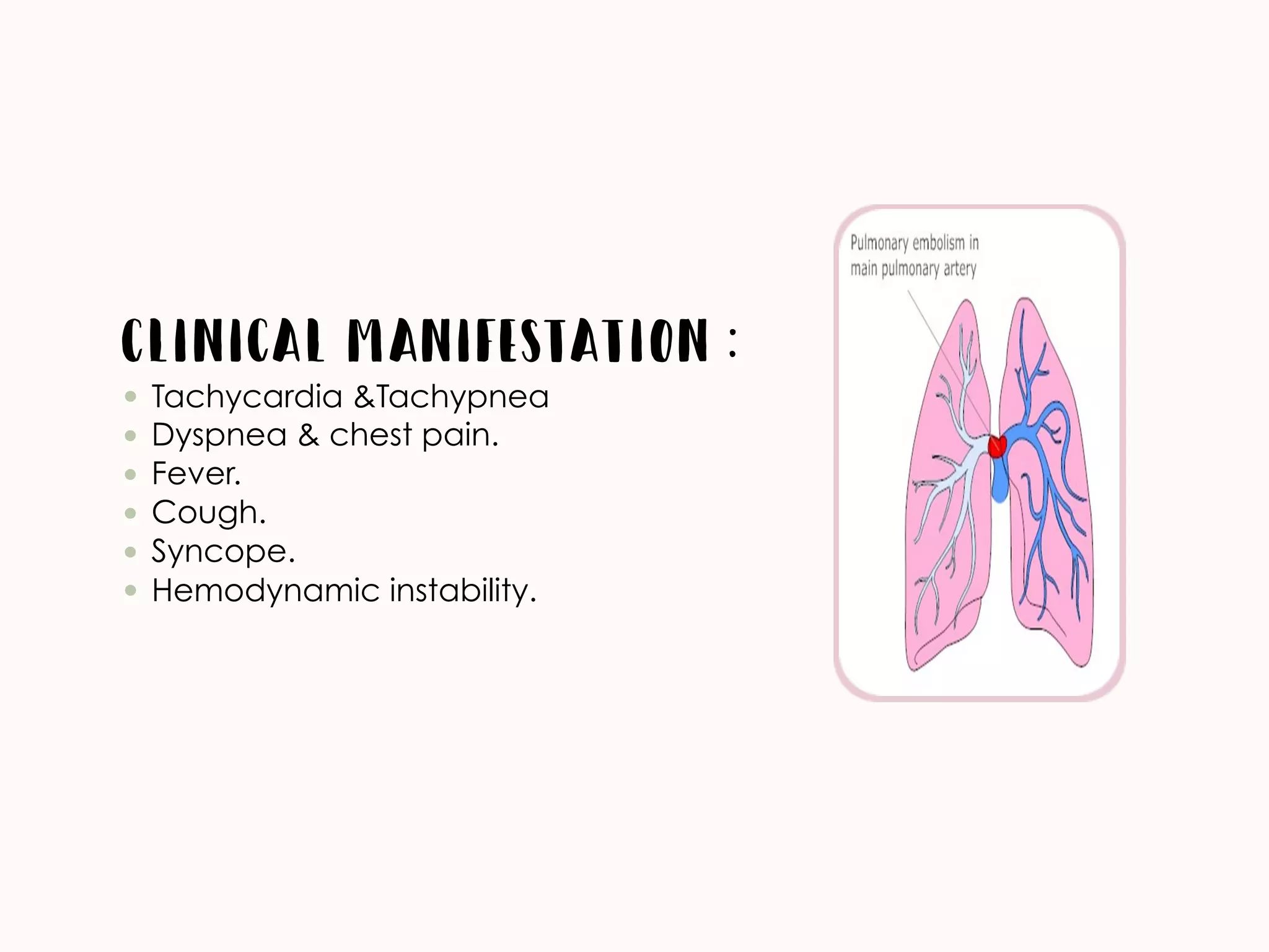 Pulmonary embolism. | PDF