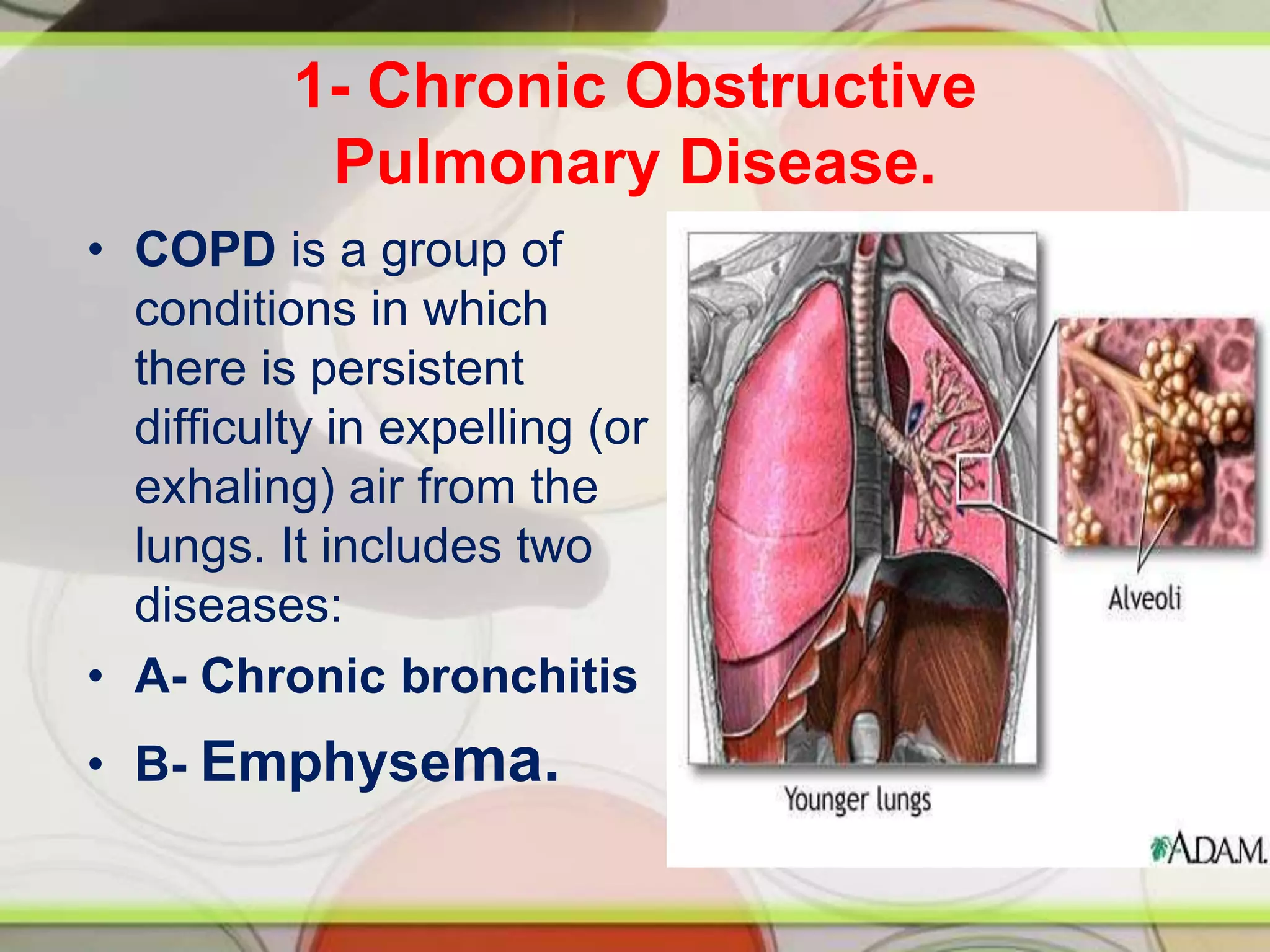 Pulmonary Diseases 2009 copy | PPT | Lung and Respiratory Health ...