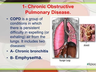 Pulmonary Diseases 2009 copy | PPT