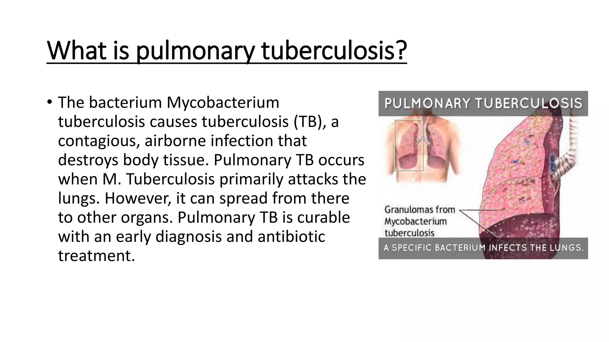 Pulmonary%20tuberculosis.pptx