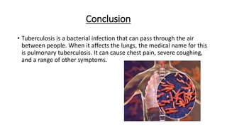 Pulmonary%20tuberculosis.pptx