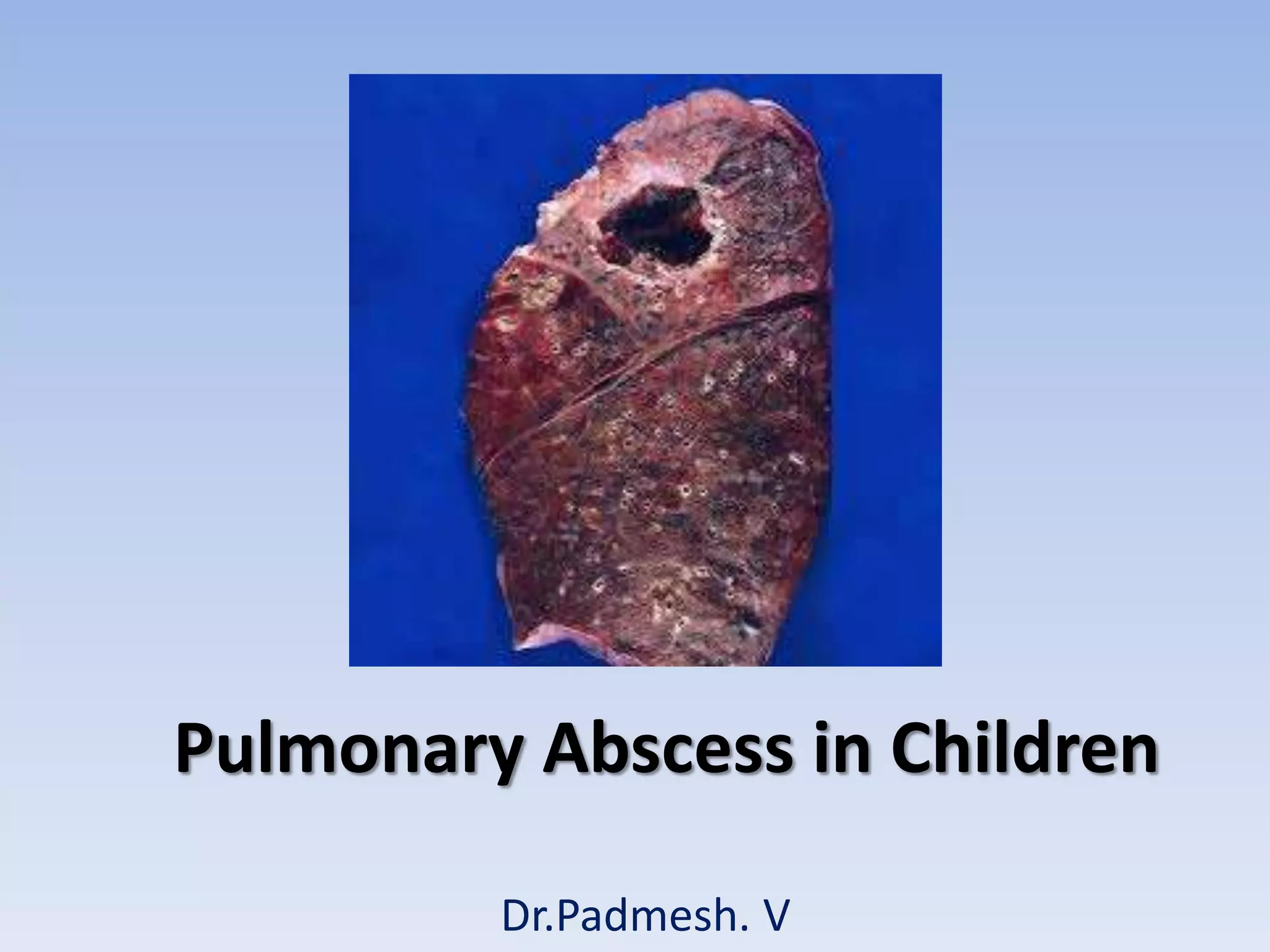 Pulmonary Abscess in Children .. Dr Padmesh | PPTX