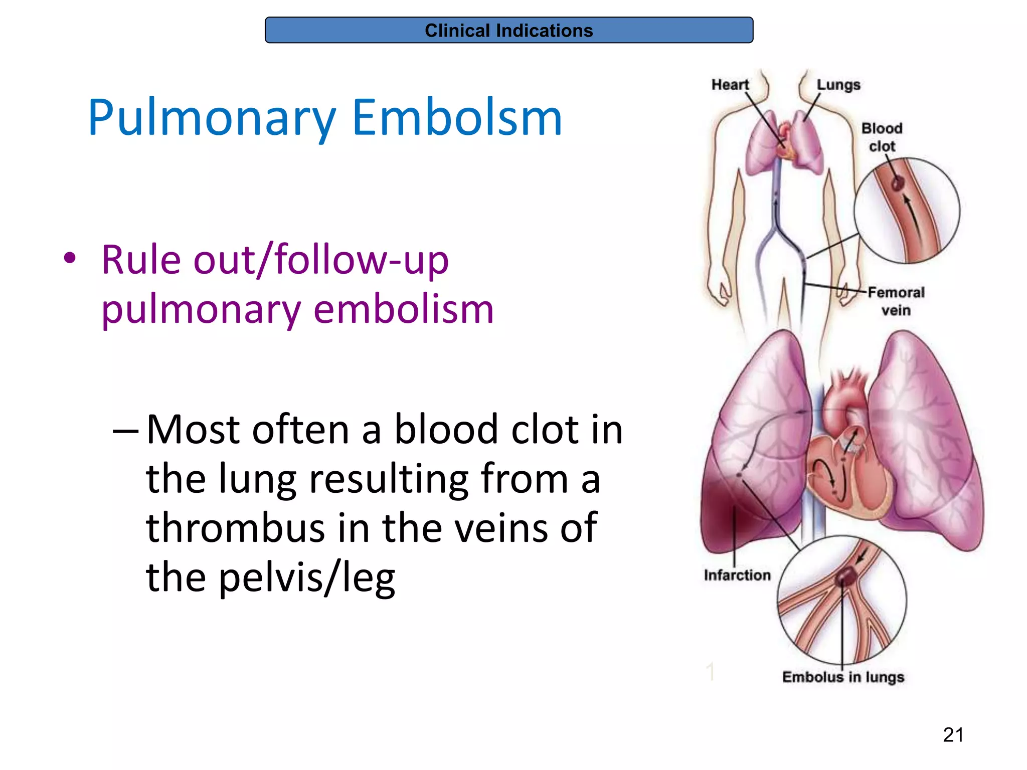 Pulmonary anat phys lung scint principles | PPTX