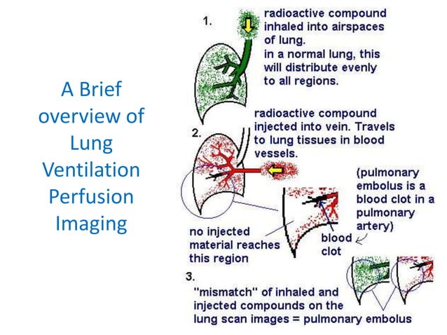 Pulmonary anat phys lung scint principles | PPTX