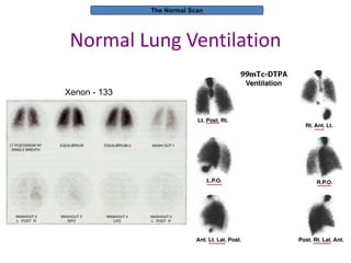 Pulmonary anat phys lung scint principles | PPTX