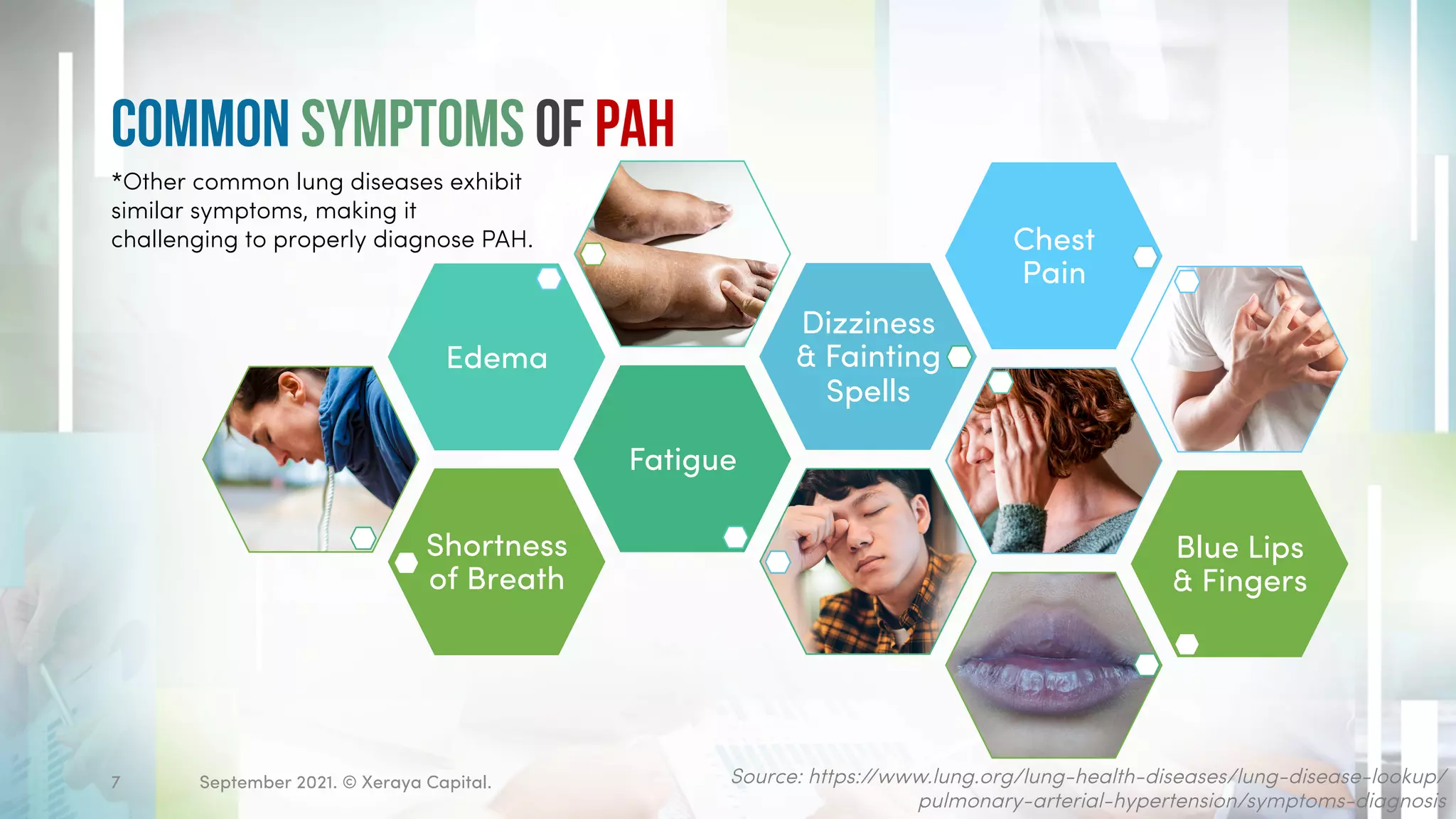 Pulmonary Arterial Hypertension (PAH): A Rare & Progressive Disorder | PDF