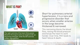 Pulmonary Arterial Hypertension (PAH): A Rare & Progressive Disorder | PDF