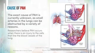 Pulmonary Arterial Hypertension (PAH): A Rare & Progressive Disorder | PDF
