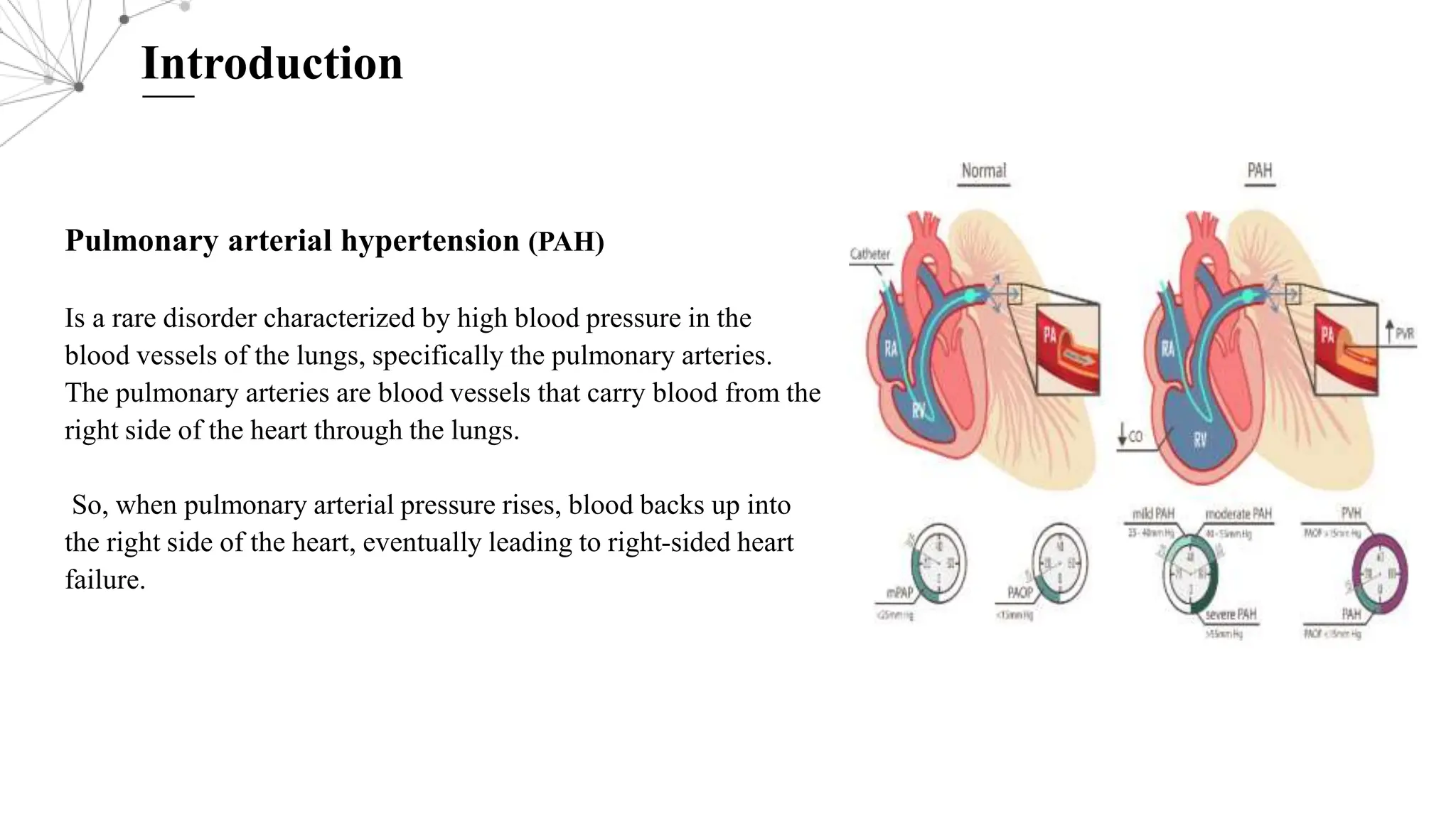 Pulmonary arterial hypertension (PAH).pptx