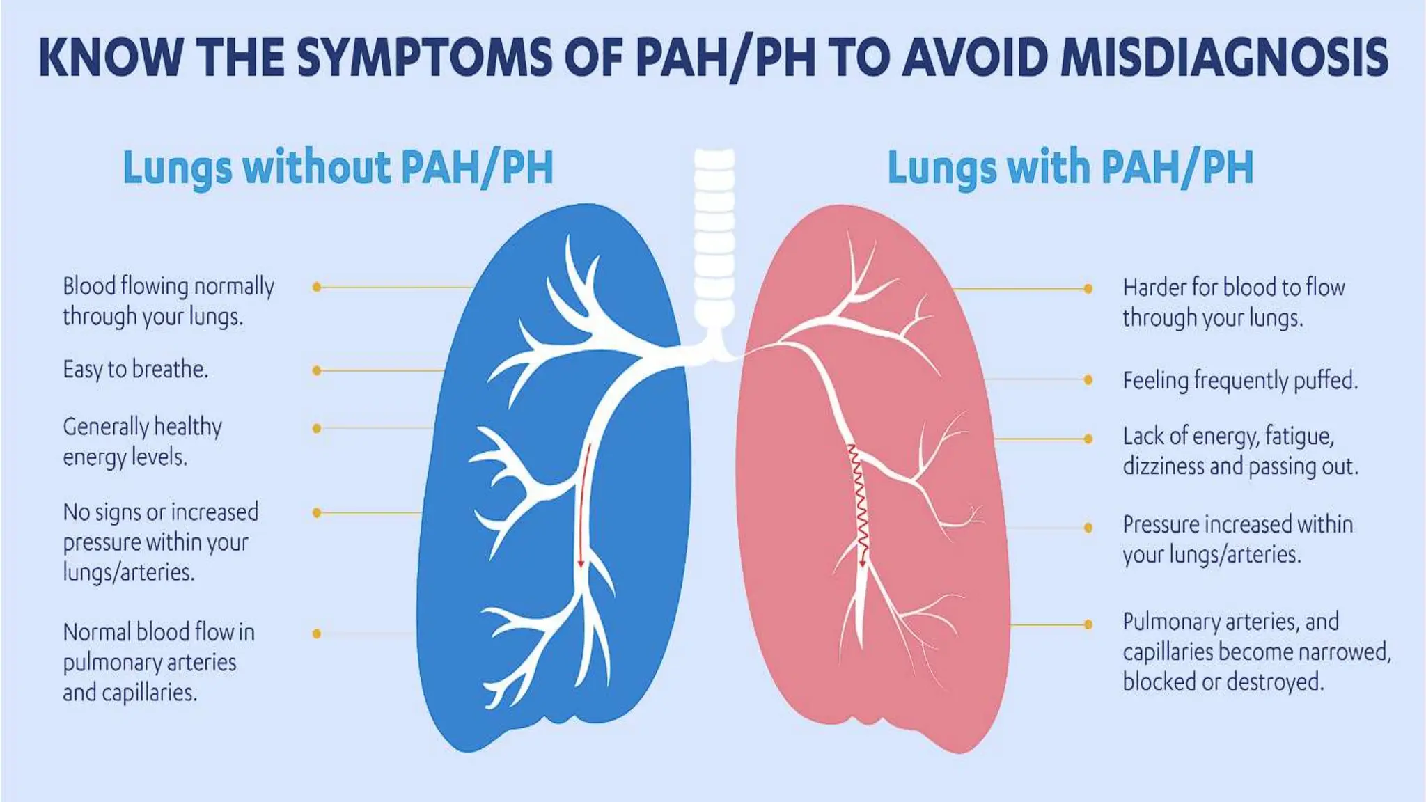 Pulmonary arterial hypertension (PAH).pptx