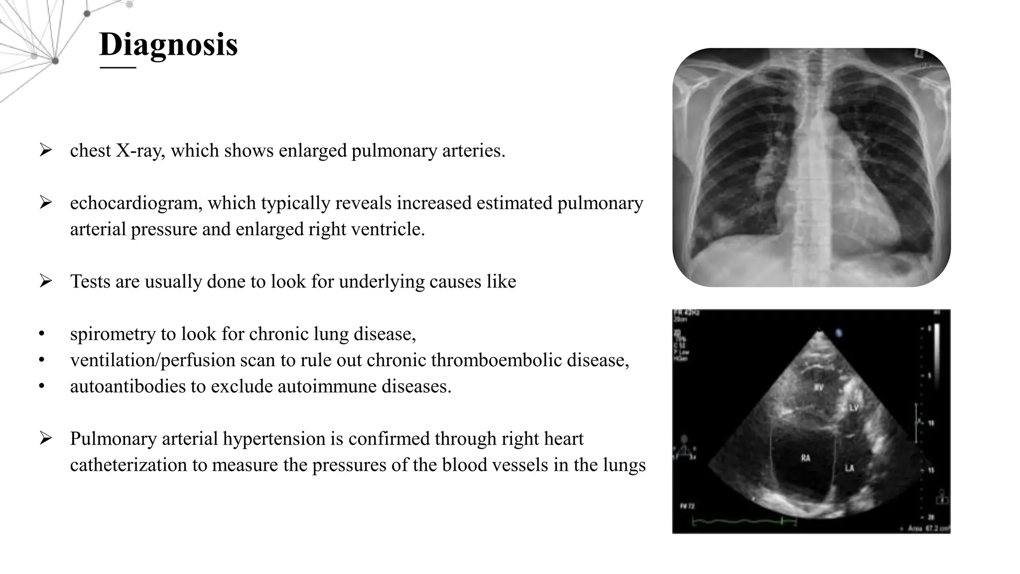 Pulmonary arterial hypertension (PAH).pptx