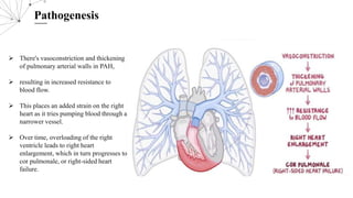 Pulmonary arterial hypertension (PAH).pptx