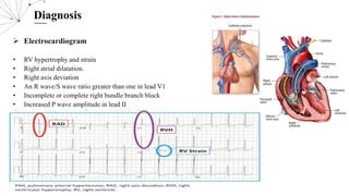 Pulmonary arterial hypertension (PAH).pptx