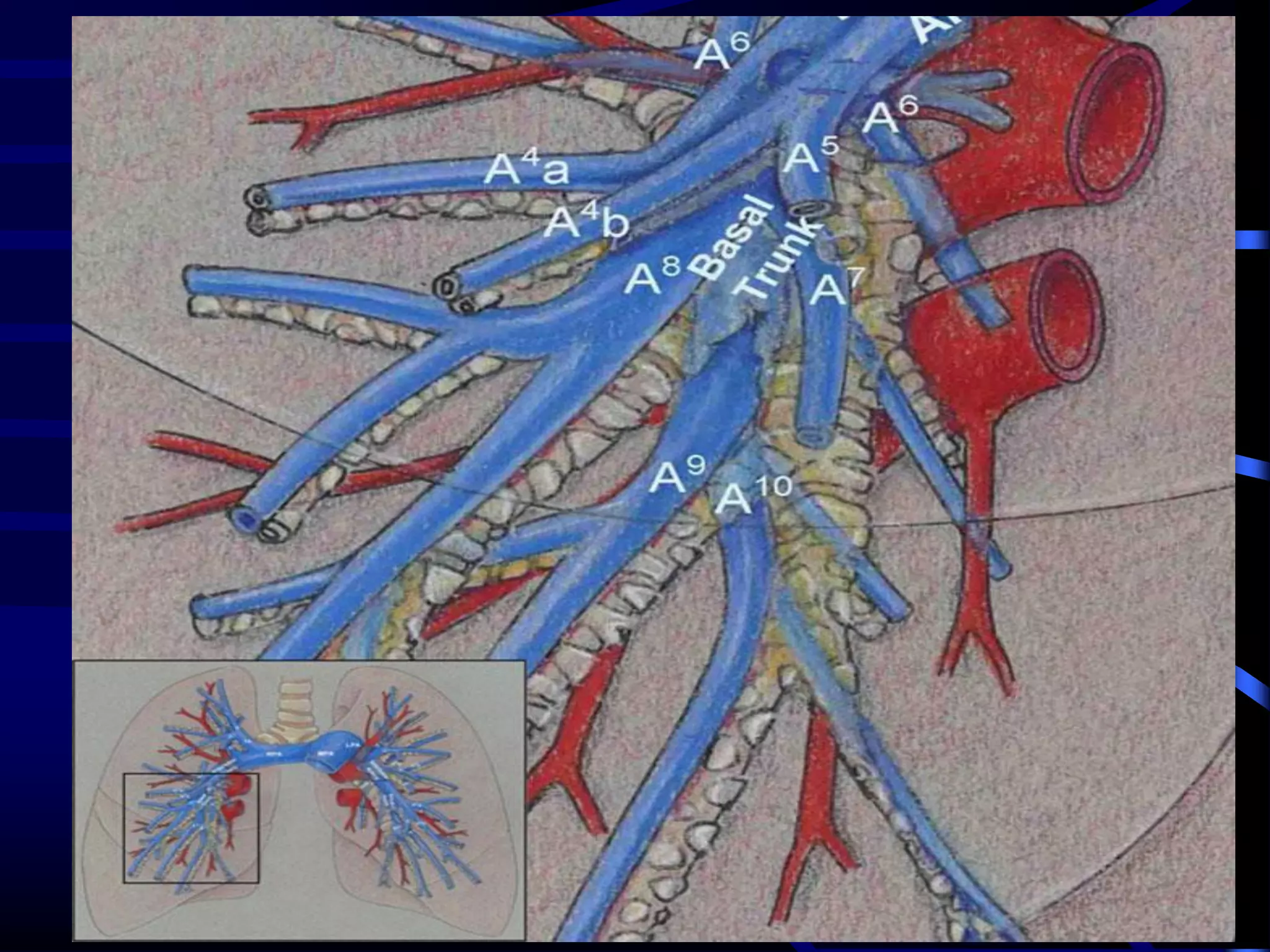Pulmonary Artery Anatomy and Pulmonary Embolism | PDF