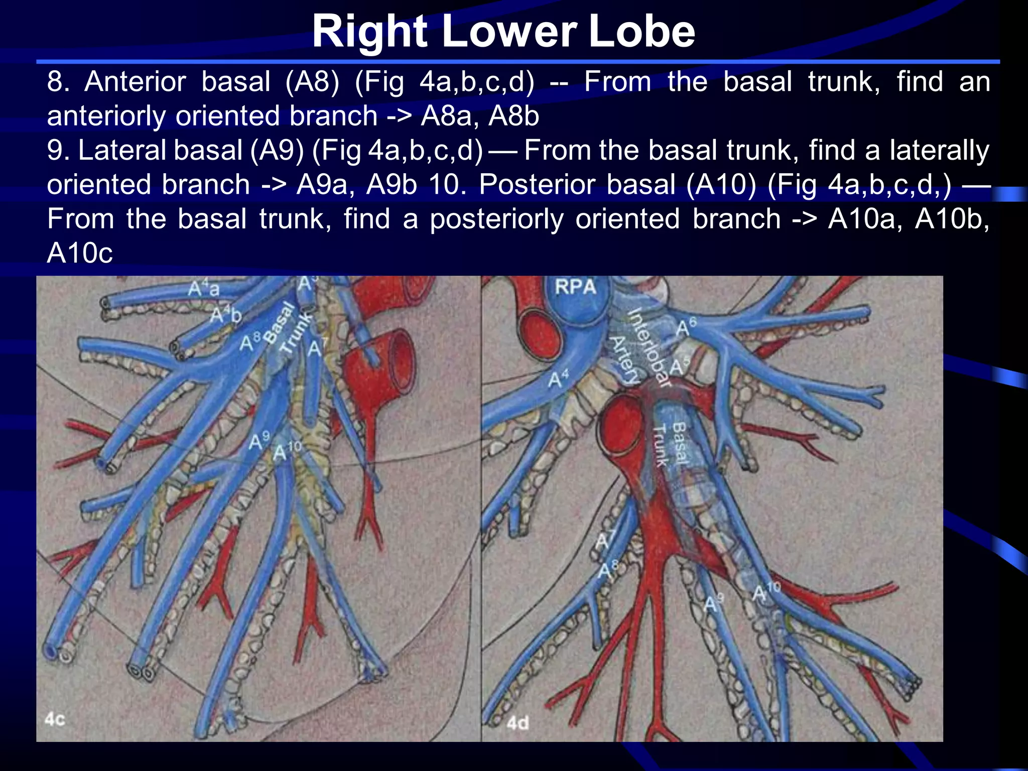 Pulmonary Artery Anatomy and Pulmonary Embolism | PDF