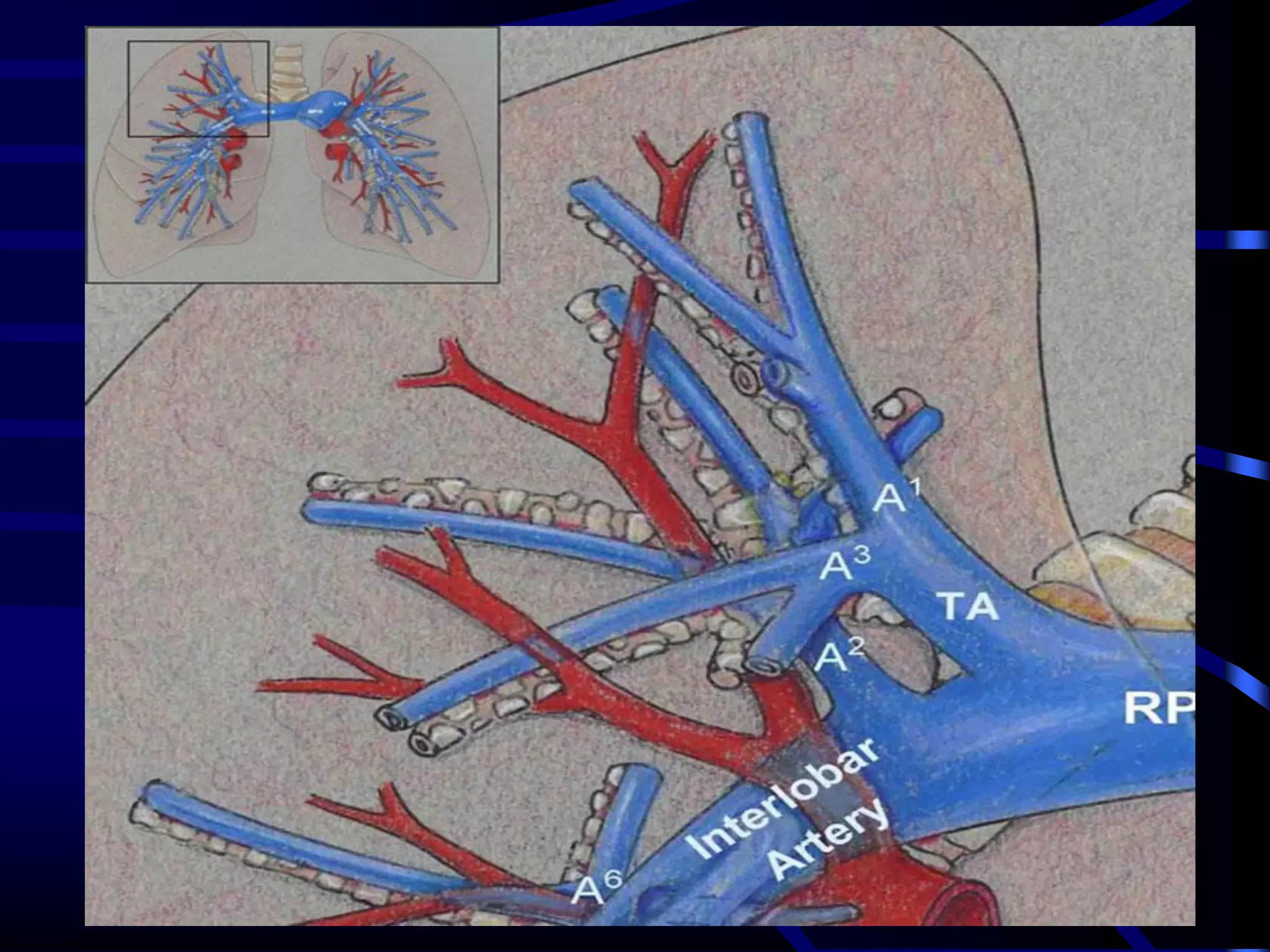 Pulmonary Artery Anatomy and Pulmonary Embolism | PDF