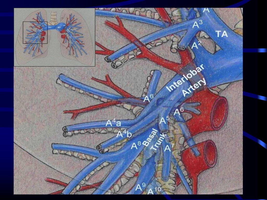 Pulmonary Artery Anatomy and Pulmonary Embolism