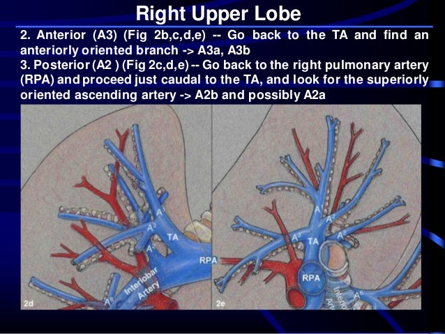 Pulmonary Artery Anatomy and Pulmonary Embolism