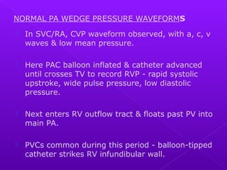 Pulmonary artery catherisation | PPT