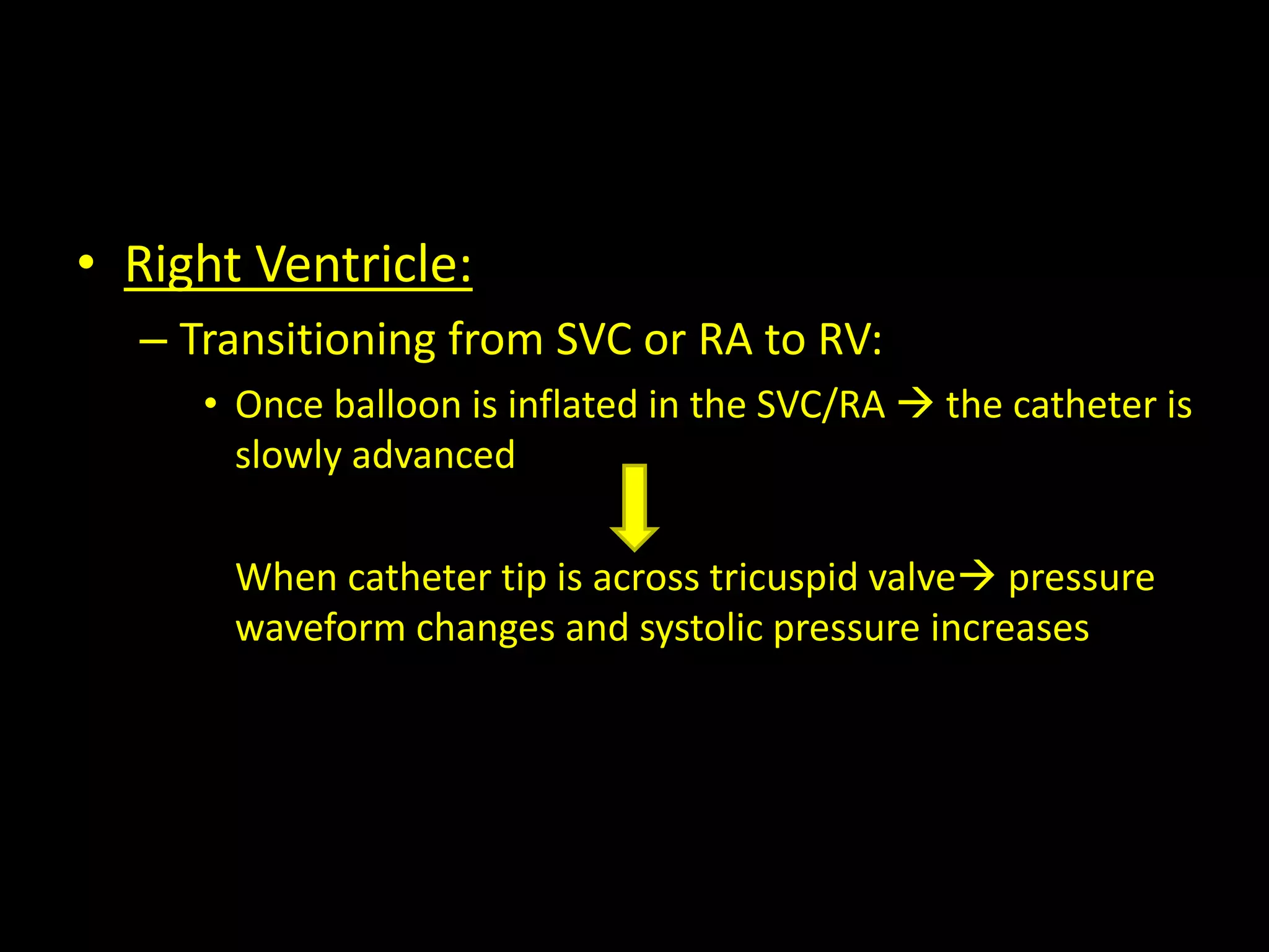Pulmonary artery catheter | PPTX