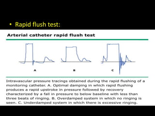 Pulmonary artery catheter | PPTX