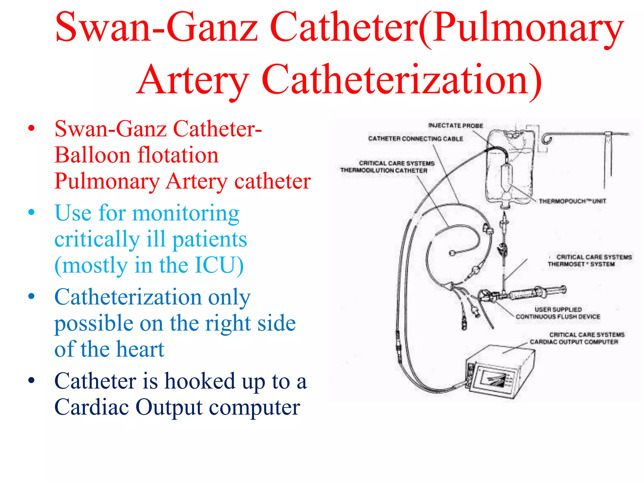 Pulmonary artery catheterization | PPT