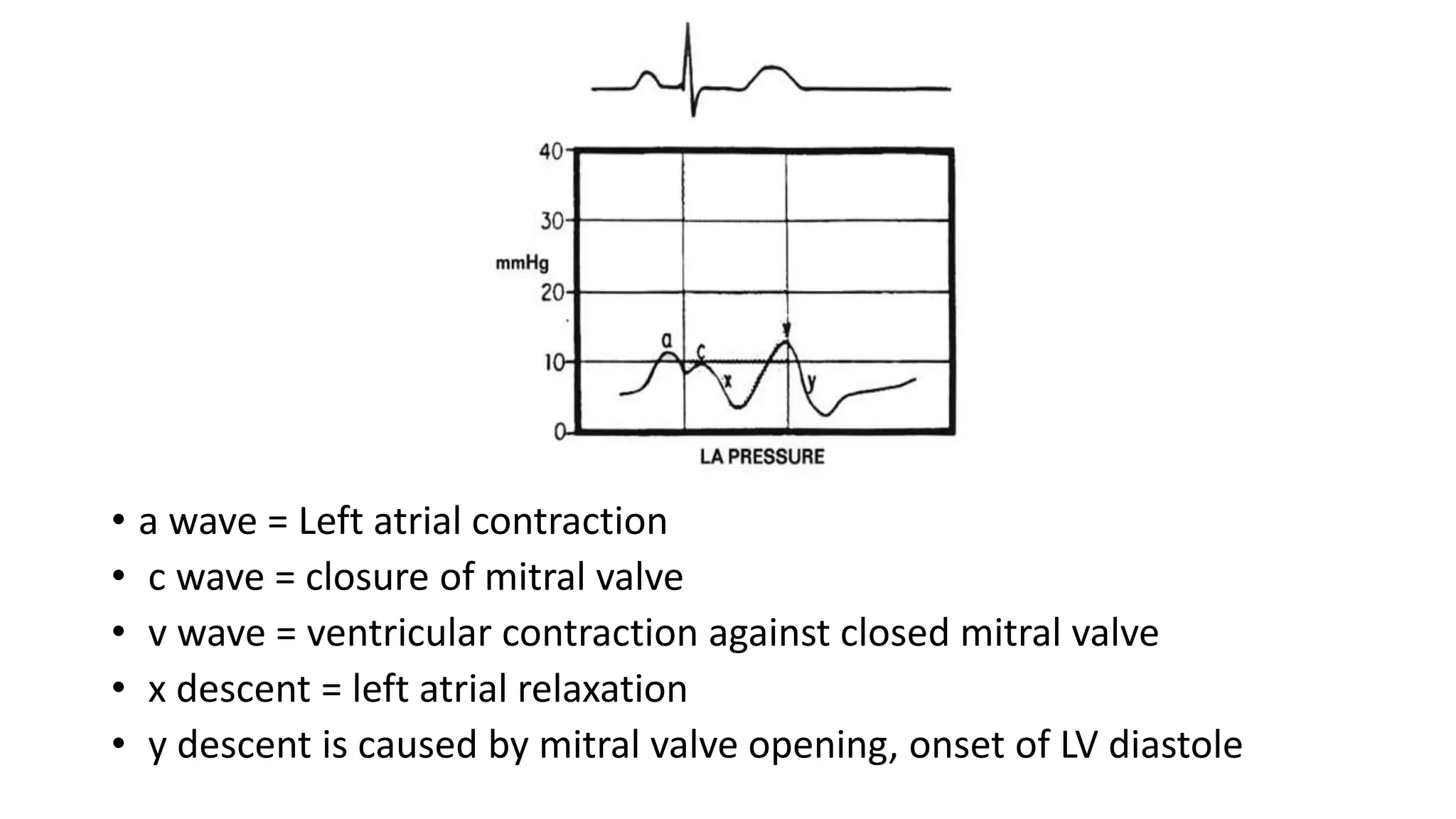 Pulmonary artery pressure monitoring | PPTX