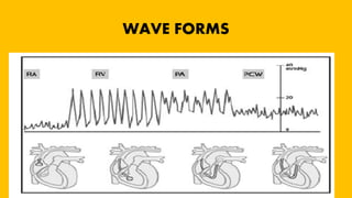 Pulmonary artery pressure monitoring | PPTX