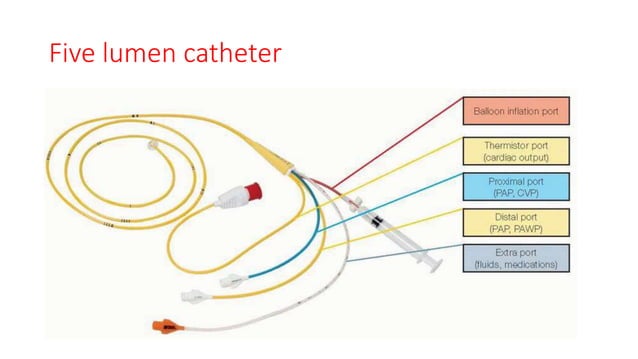 Pulmonary artery pressure monitoring | PPTX | First Aid | Injuries