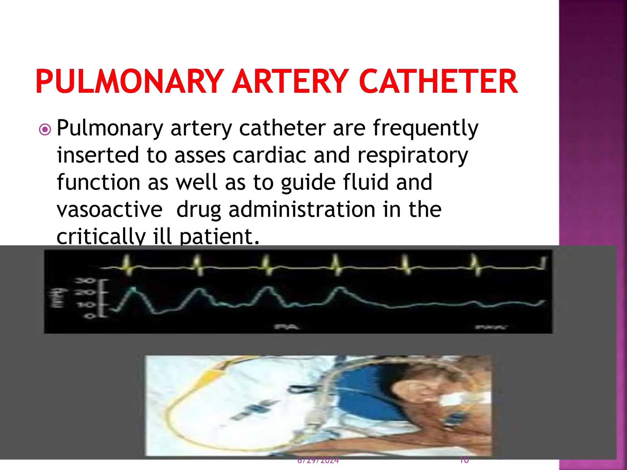 Pulmonary Artery Pressure Monitoring.pptx