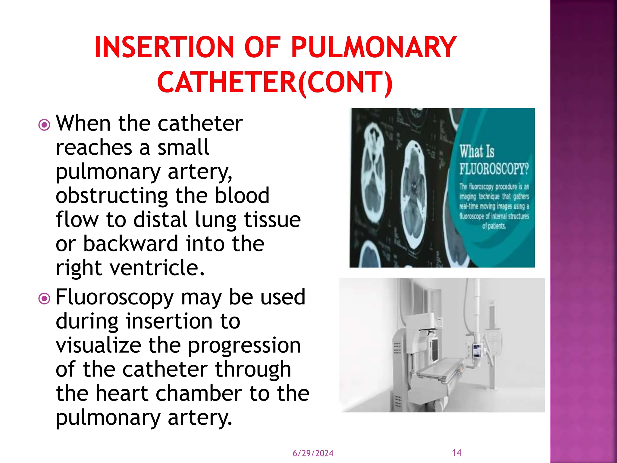 Pulmonary Artery Pressure Monitoring.pptx