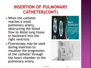 Pulmonary Artery Pressure Monitoring.pptx