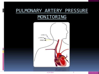 Pulmonary Artery Pressure Monitoring.pptx