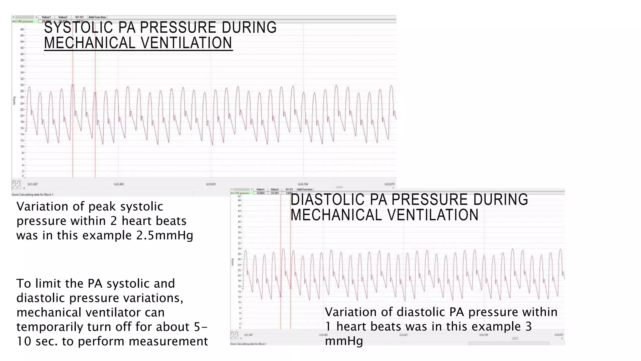 Pulmonary artery pressure rat open chest | PPTX