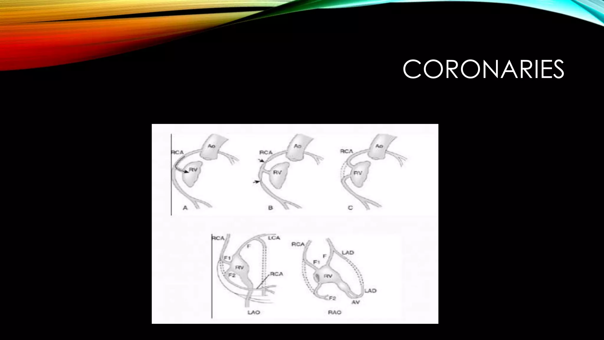 Pulmonary atresia with intact ventricular septum | PPTX