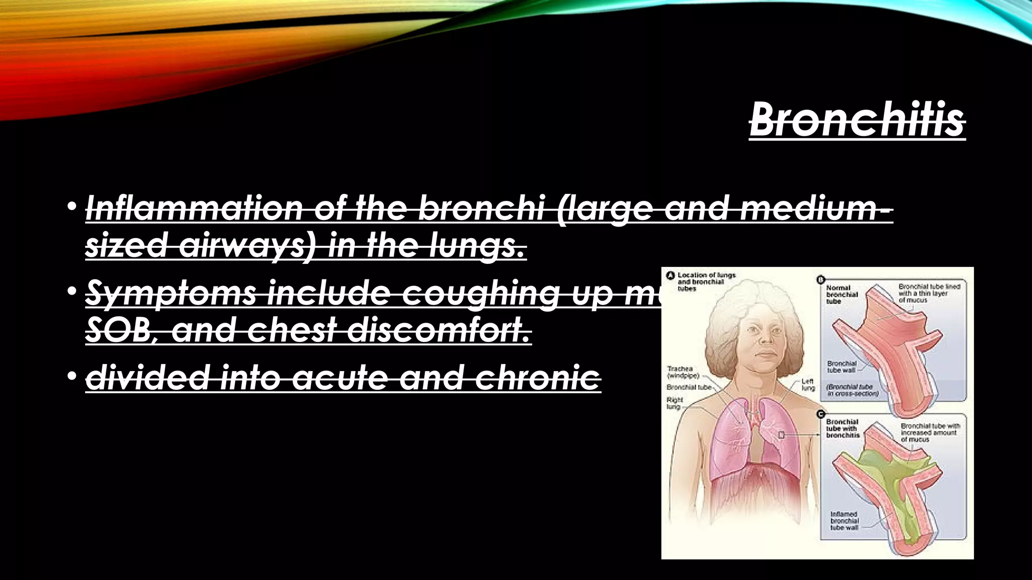 Pulmonary causes of chest pain | PPT