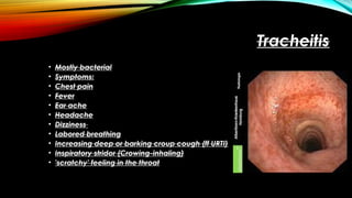 Pulmonary causes of chest pain | PPT