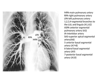 PULMONARY CIRCULATION including anatomy.pptx