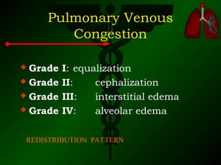 Pulmonary Circulation in Radiography.ppt