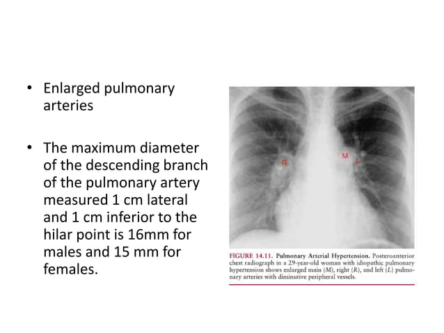 Imaging in pulmonary circulation disease | PPT