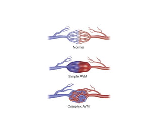 pulmonary circulation ppt final including vessels | PPTX