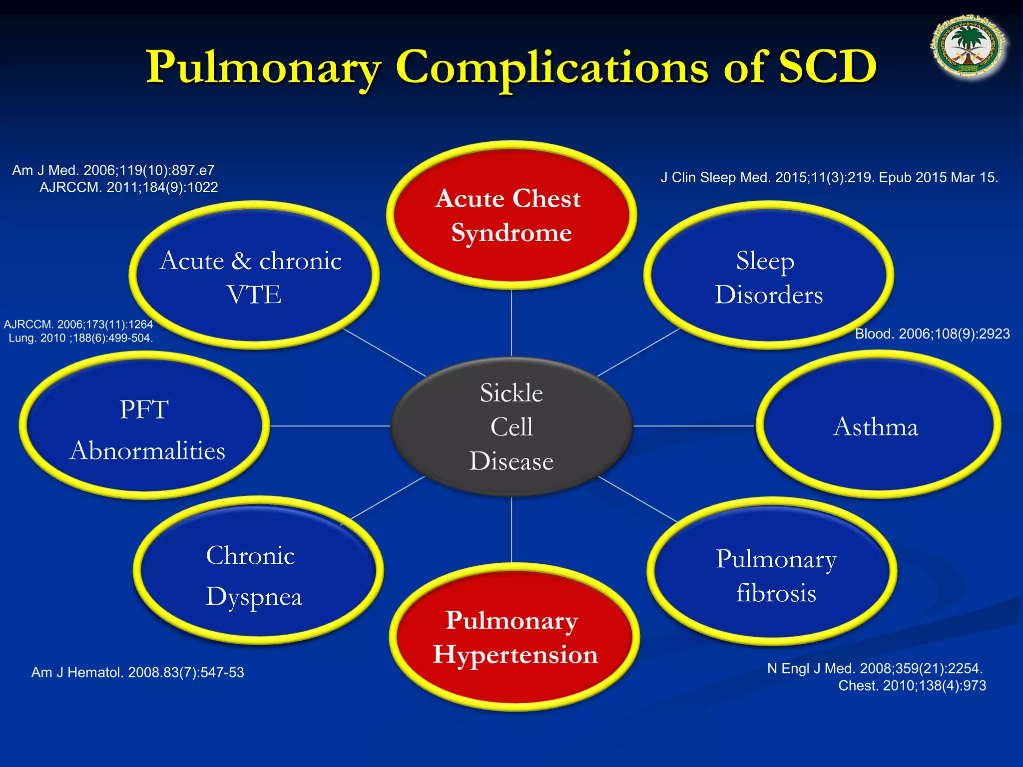 Pulmonary Complications of Sickle Cell Disease. pptx | PDF