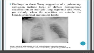 Pediatric Pulmonary Contusion